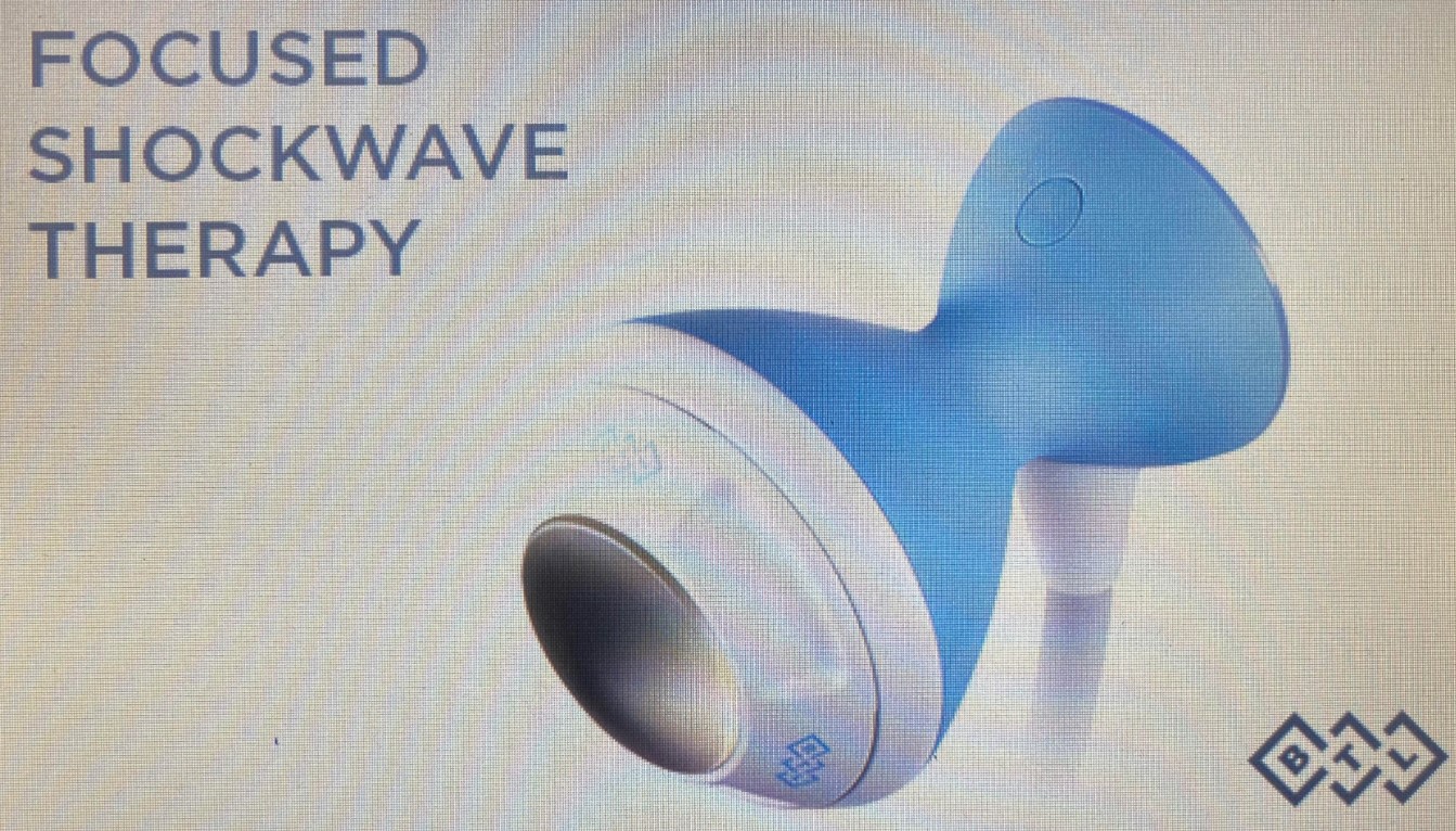 FOCUSED SHOCKWAVE THERAPY - Αθ. Κωταντούλας - Εξειδικευμένη ...